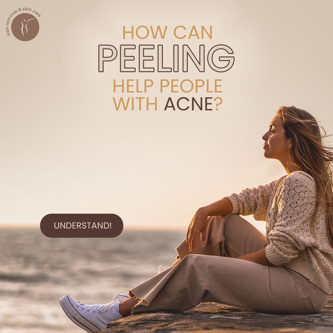 How can peeling help people with acne